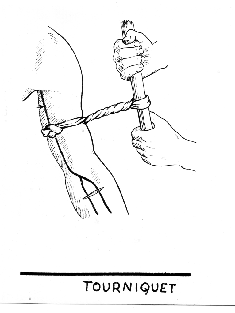How and When to Use a Tourniquet How and When to Use a Tourniquet